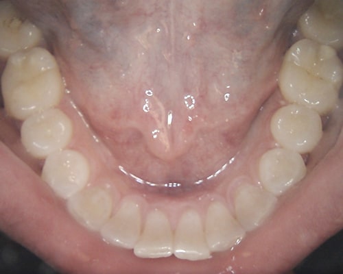 CS 1500 Intraoral Camera | Imaging Solutions