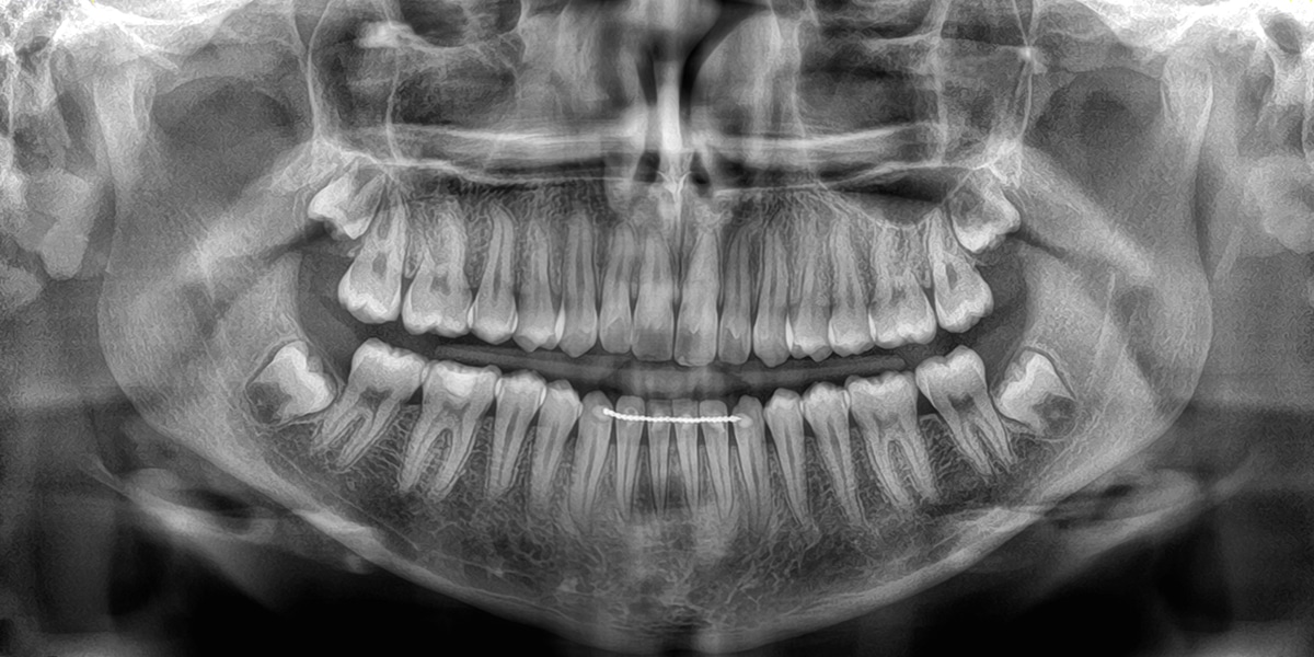 CS 8200 CBCT | Imaging Solutions