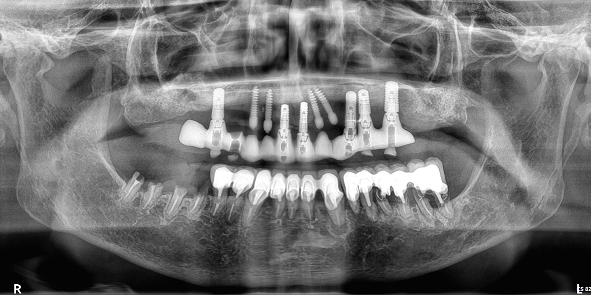 CS 8200 CBCT | Imaging Solutions