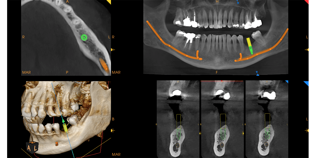 CS 8200 CBCT | Imaging Solutions