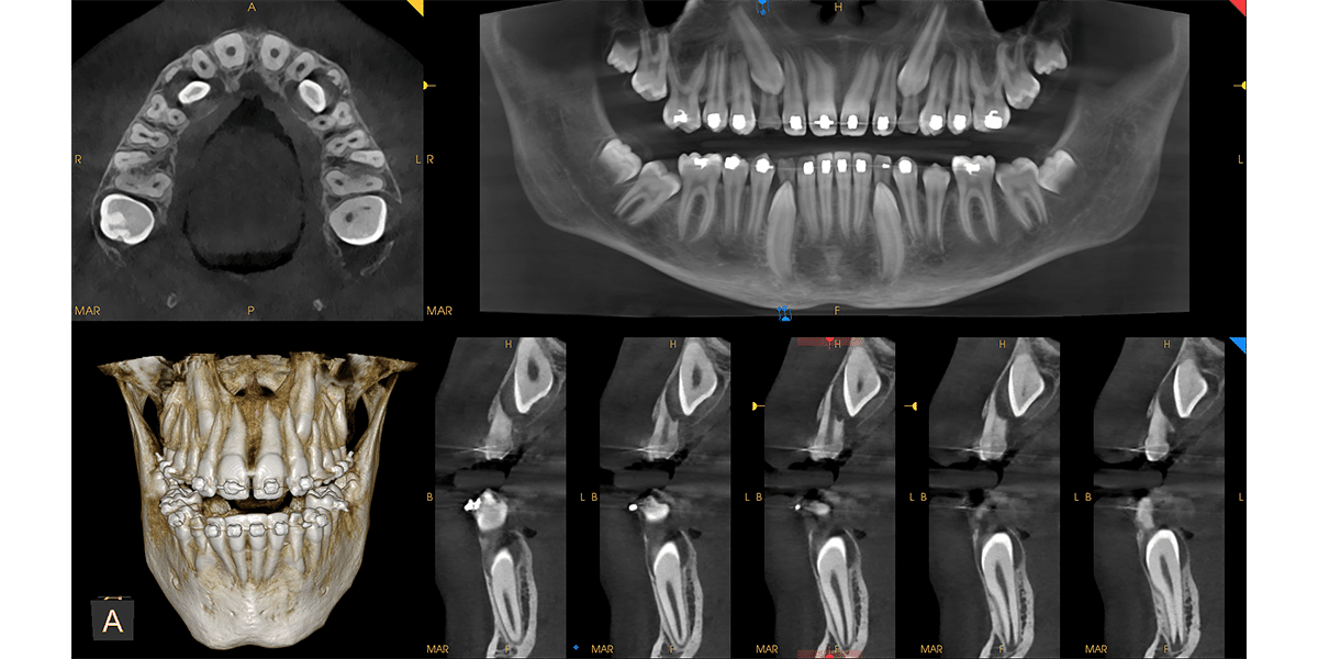 CS 8200 CBCT | Imaging Solutions