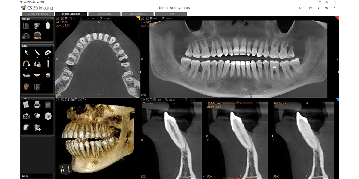CS 8200 CBCT | Imaging Solutions