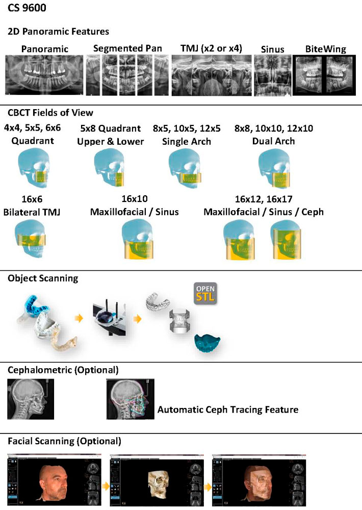 CS 9600 CBCT | Imaging Solutions