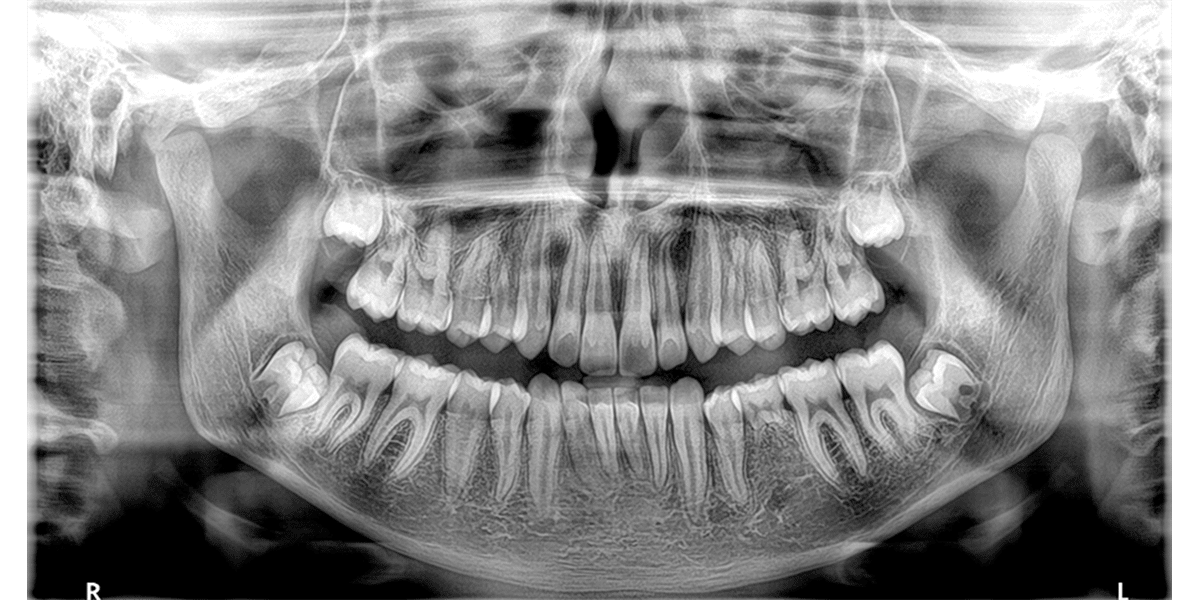 CS 9600 Scan Ceph CBCT | Imaging Solutions