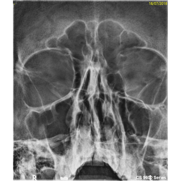 CS 9600 CBCT | Imaging Solutions