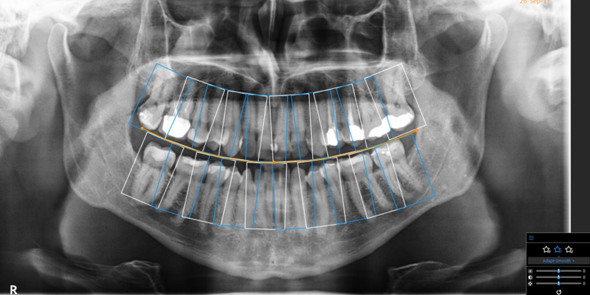 CS 9600 CBCT | Imaging Solutions