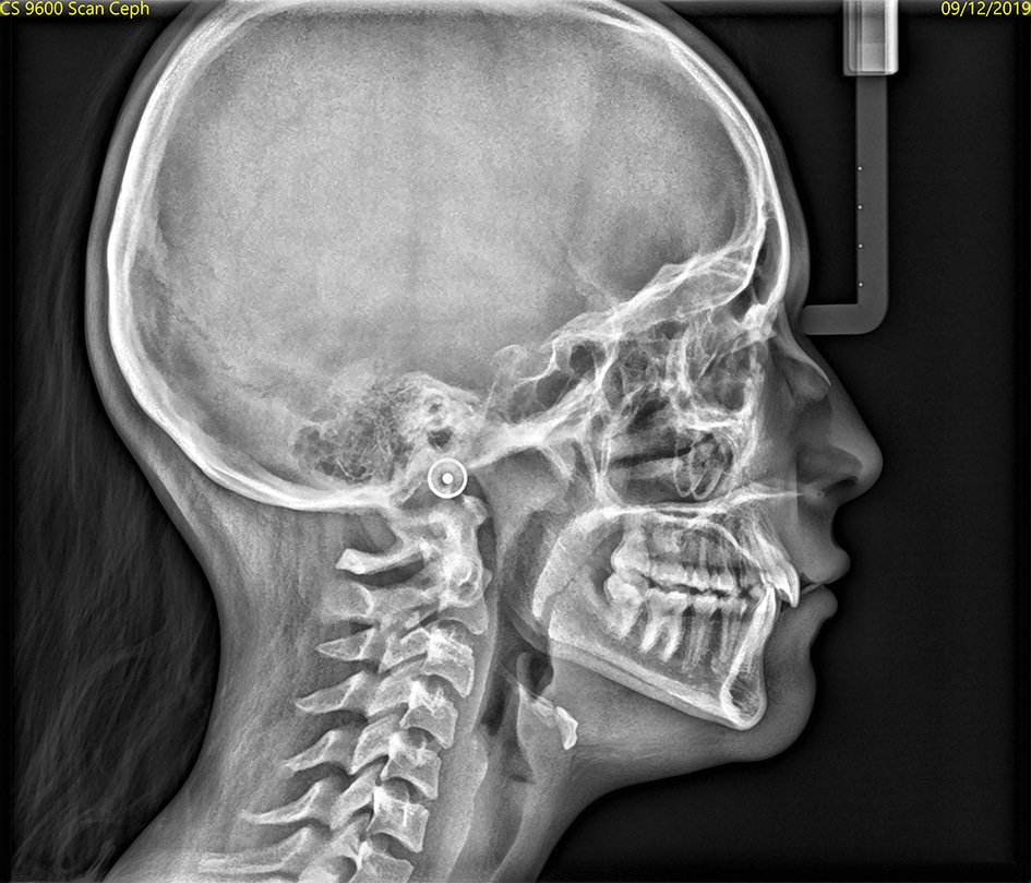 CS 9600 CBCT | Imaging Solutions