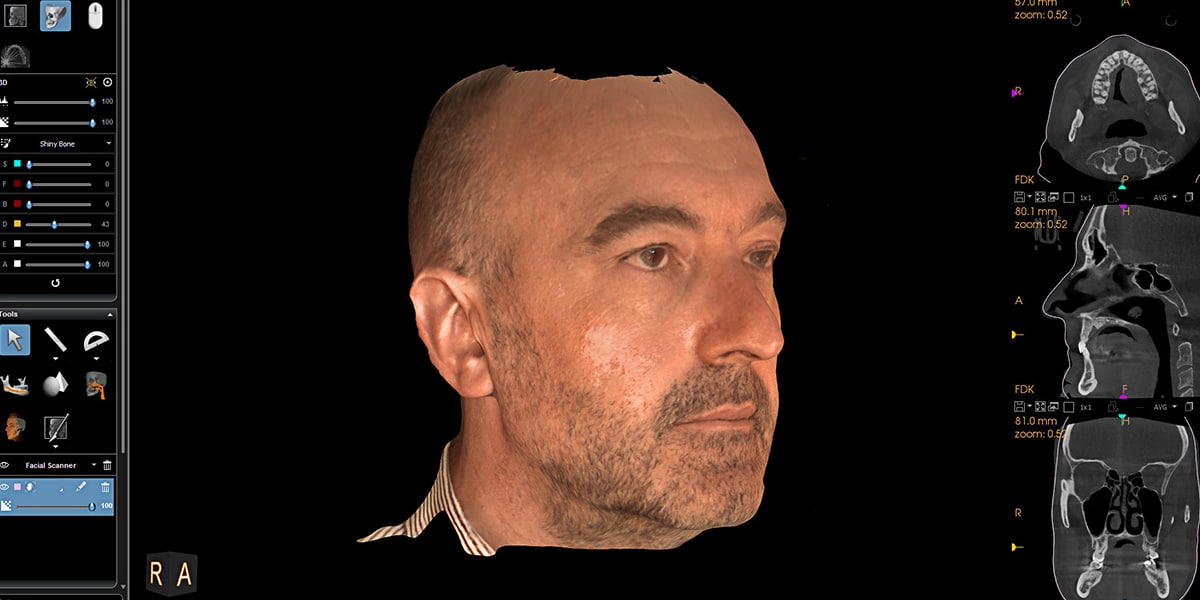 CS 9600 CBCT | Imaging Solutions