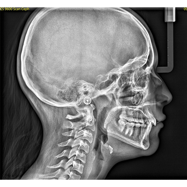 CS 9600 Scan Ceph CBCT | Imaging Solutions