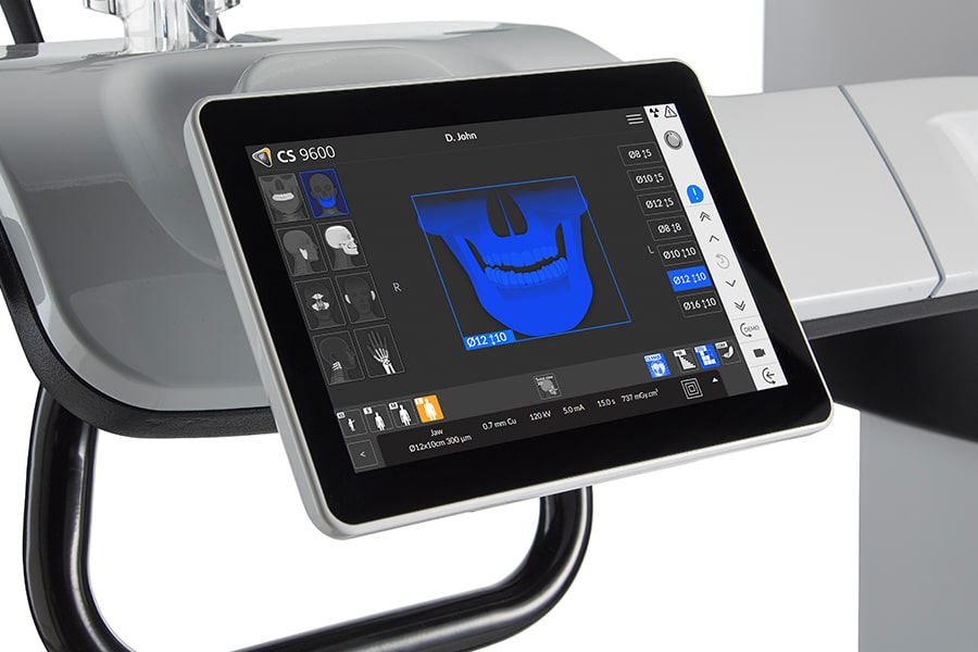 CS 9600 CBCT | Imaging Solutions