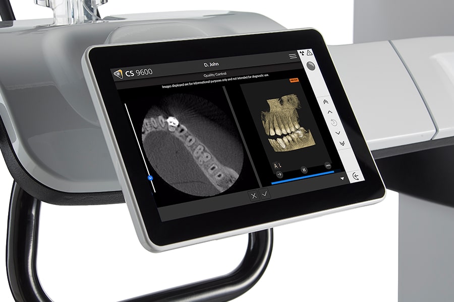 CS 9600 CBCT | Imaging Solutions