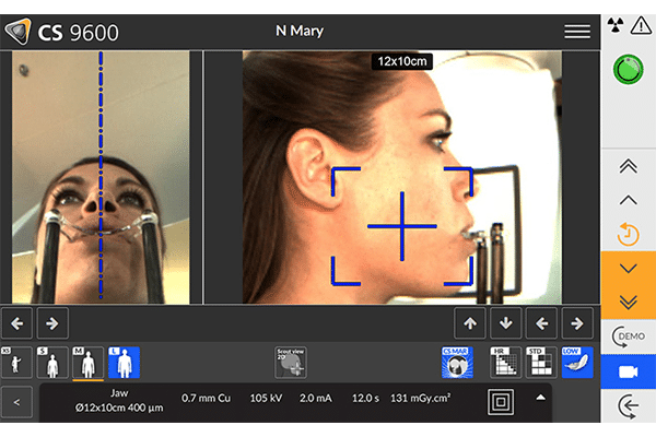 CS 9600 CBCT | Imaging Solutions