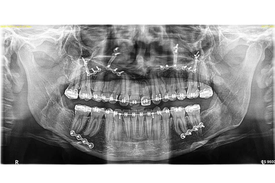CS 9600 Scan Ceph CBCT | Imaging Solutions