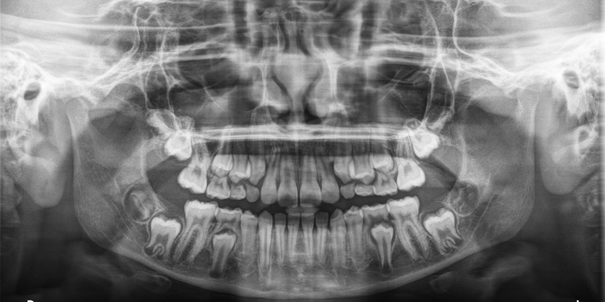 Panoramic X-Rays | Imaging Solutions
