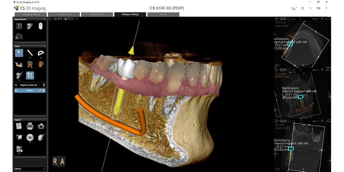CS PDIP | Imaging Solutions